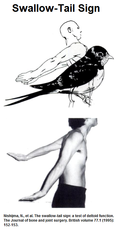 Signs of Deltoid Dysfunction From Axillary Nerve Palsy – newpainmuse