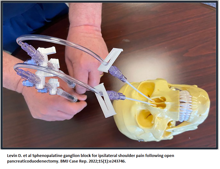 newpainmuse – New Innovations in pain management
